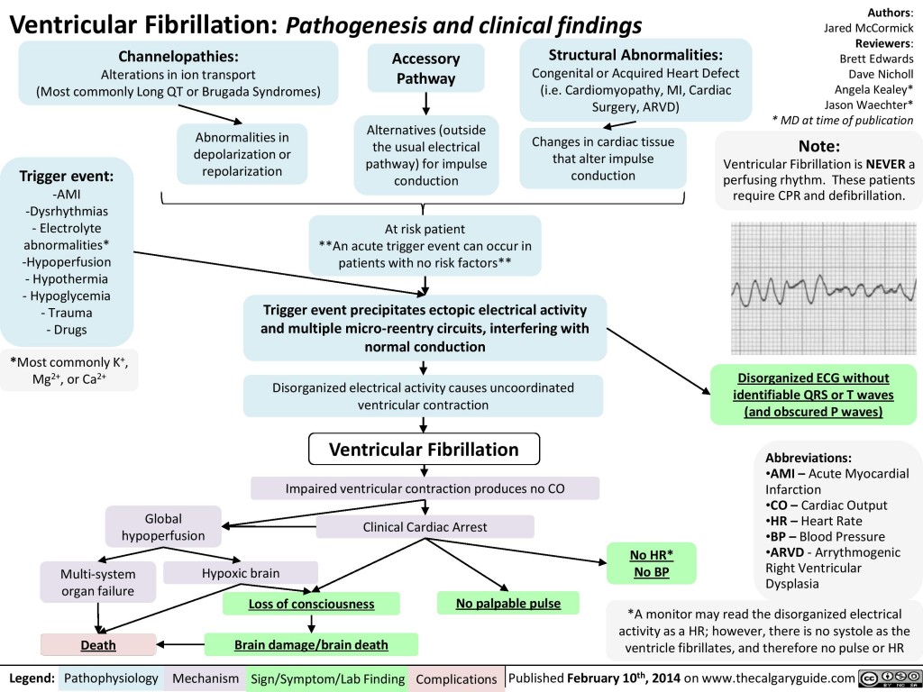 Ventricular Fibrillation: Pathogenesis and clinical findings | Calgary ... Ventricular Fibrillation: Pathogenesis and clinical findings | Calgary ...