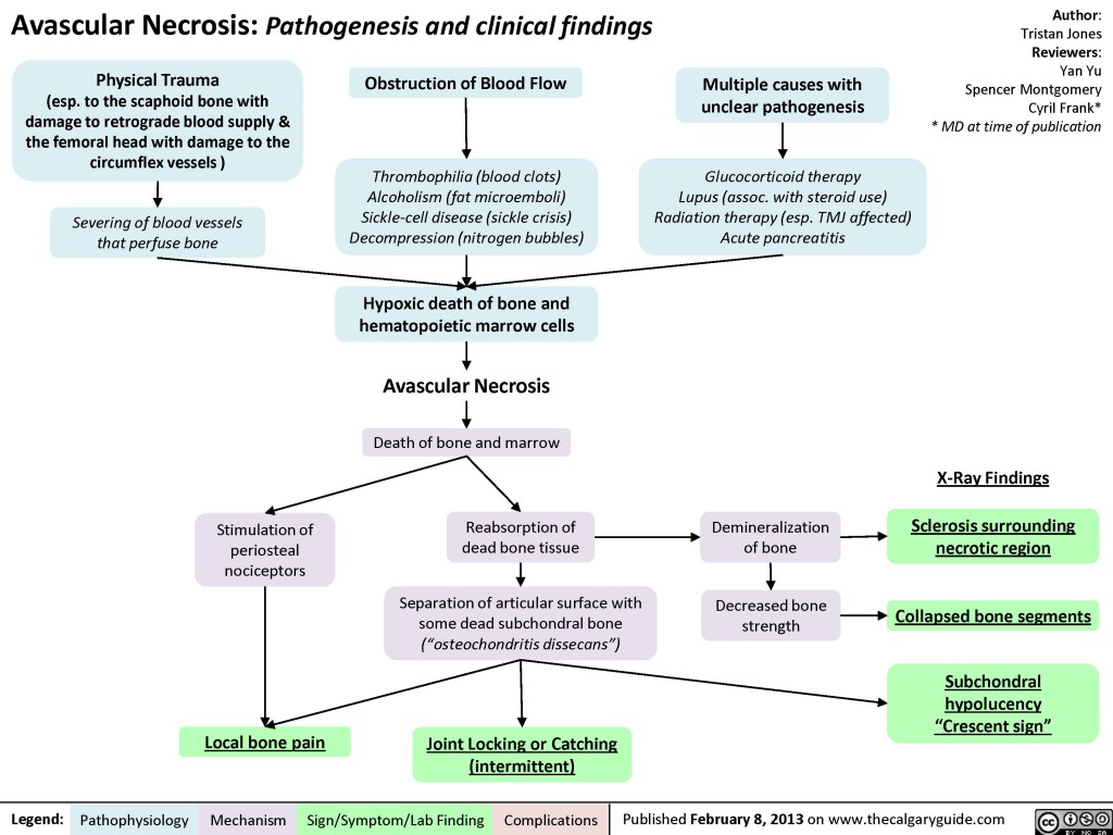 Avascular Necrosis: Pathogenesis and Clinical Findings | Calgary ...
