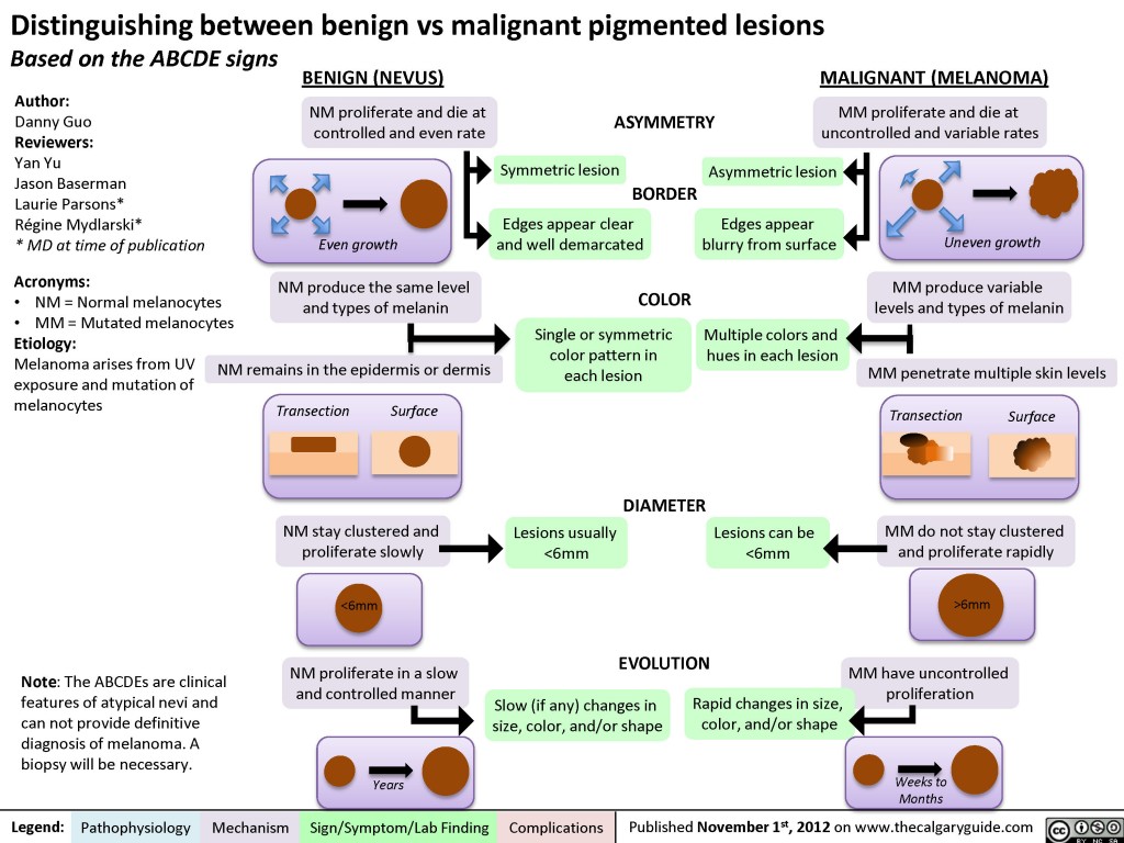 Distinguishing between Benign and Malignant Pigmented Lesions | Calgary ...
