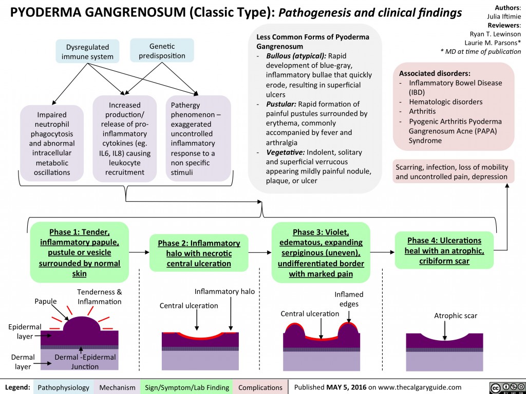 Slide1 | Calgary Guide