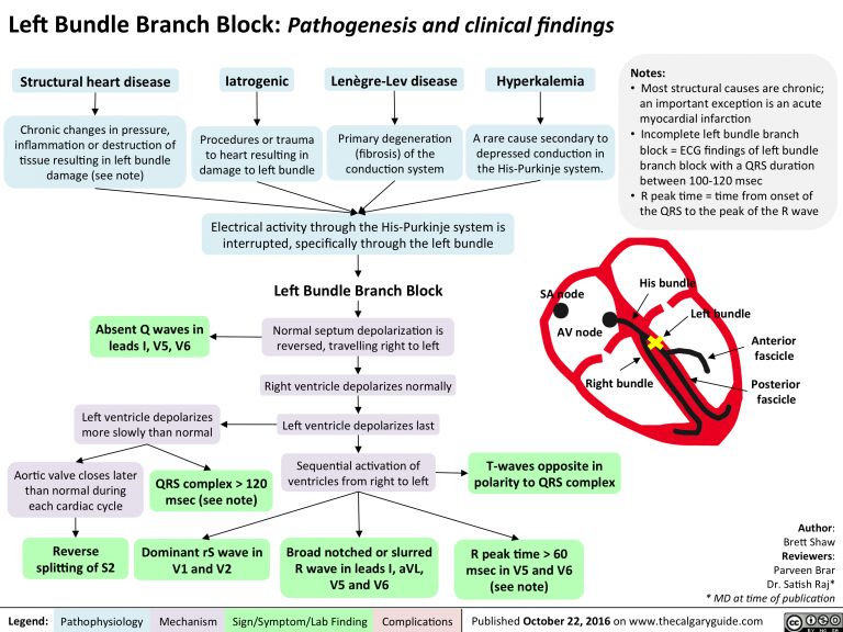 Left Bundle Branch Block: Pathogenesis and clinical findings | Calgary ...