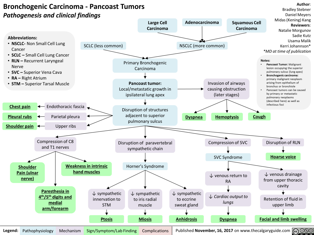 Bronchogenic Carcinoma – Pancoast Tumors Pathogenesis and Clinical Findings | Calgary Guide