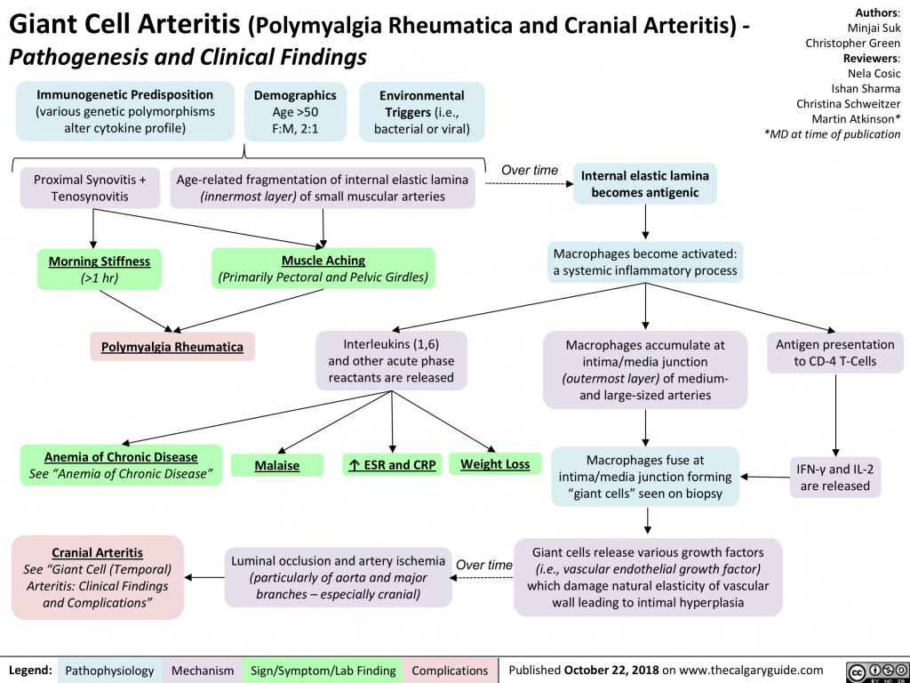 Giant Cell Arteritis: Pathogenesis and Clinical Findings | Calgary Guide