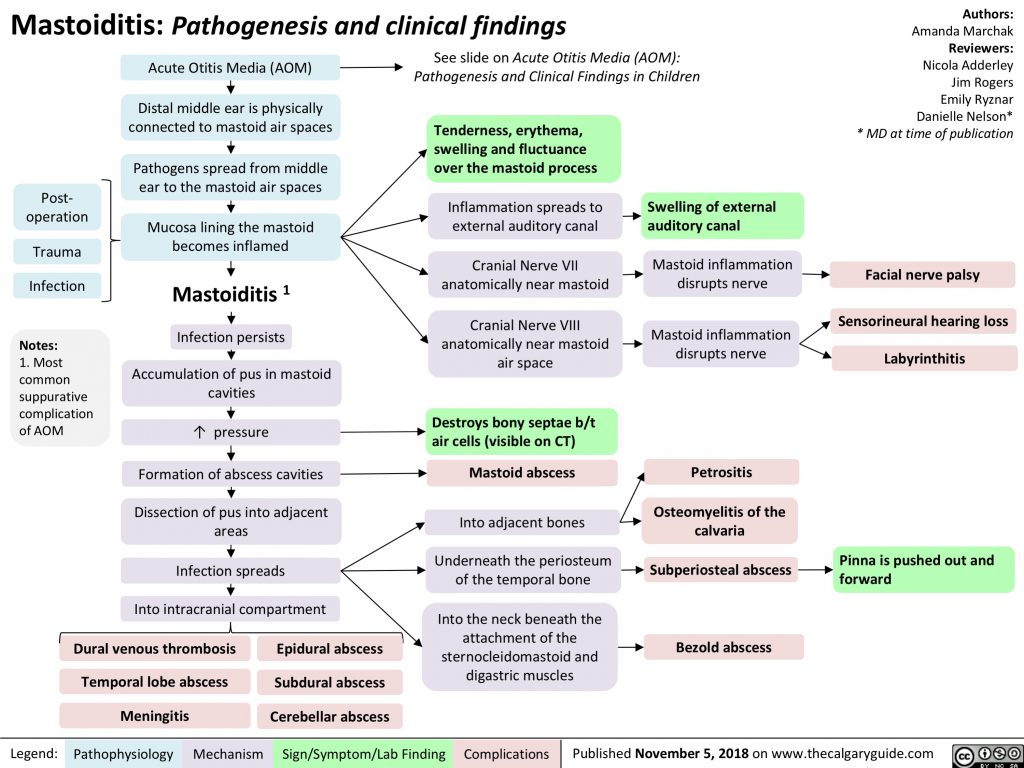 Mastoiditis: Pathogenesis and clinical findings | Calgary GuideCalgary ...