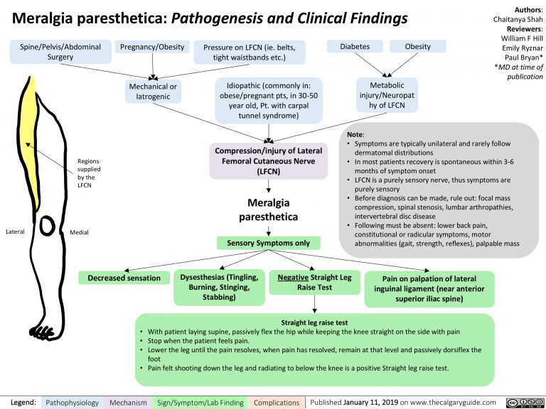 Meralgia paresthetica: Pathogenesis and Clinical Findings | Calgary ...