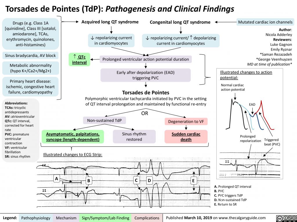 Torsades de Pointes (TdP): Pathogenesis and Clinical Findings | Calgary ...