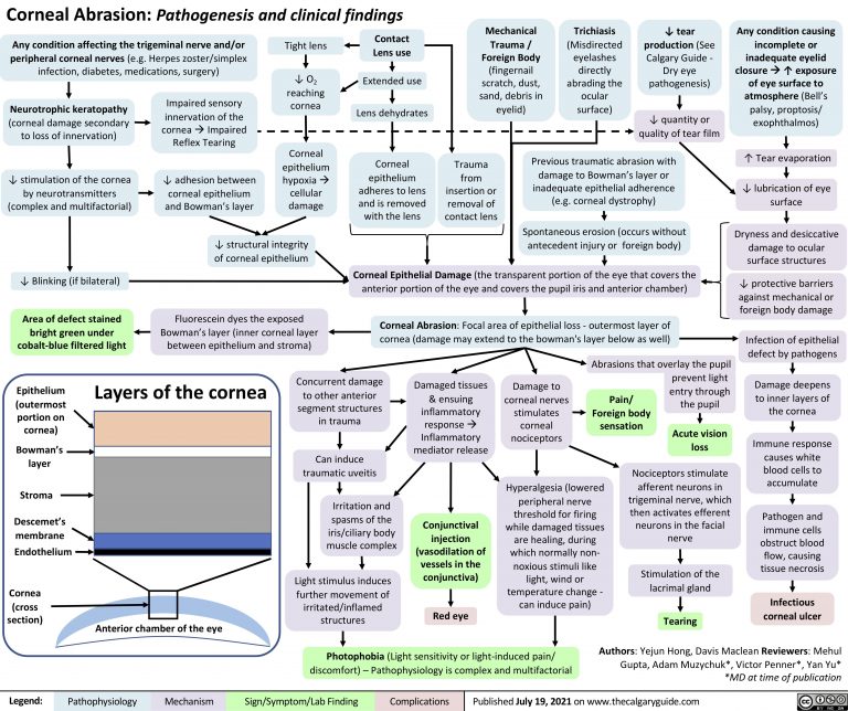 Corneal-Abrasion | Calgary GuideCalgary Guide