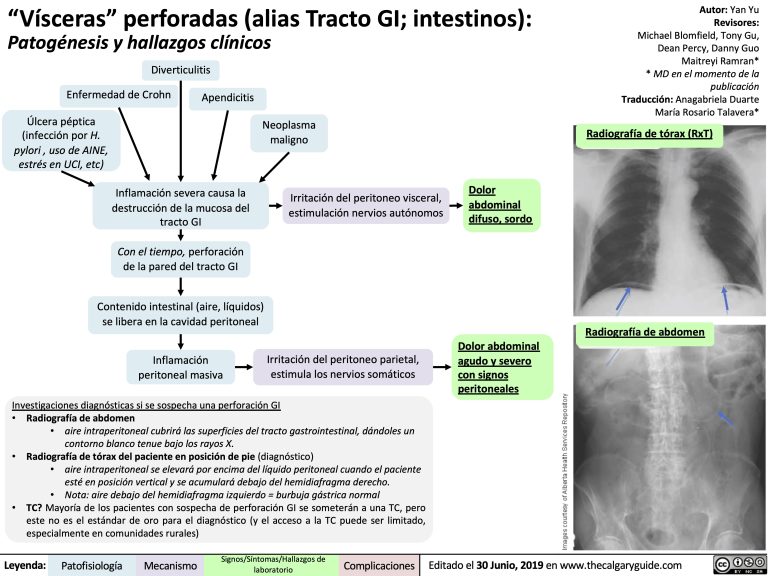 visceras-perforadas-alias-tracto-gi-intestinos | Calgary Guide