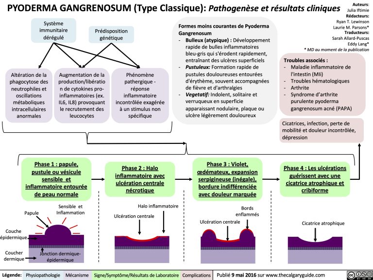 Pyoderma Gangrenosum (Type Classique): Pathogenèse et résultats ...