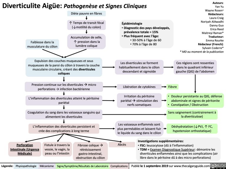 Diverticulite Aigüe: Pathogenèse et Signes Cliniques | Calgary ...