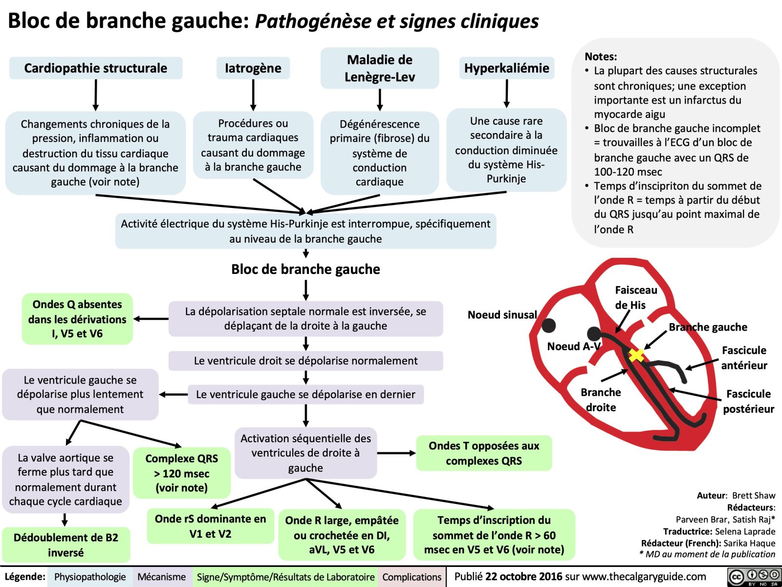 Bloc de branche gauche: Pathogénèse et signes cliniques | Calgary ...