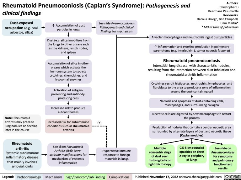 Rheumatoid Pneumoconiosis Caplans Syndrome Pathogenesis And