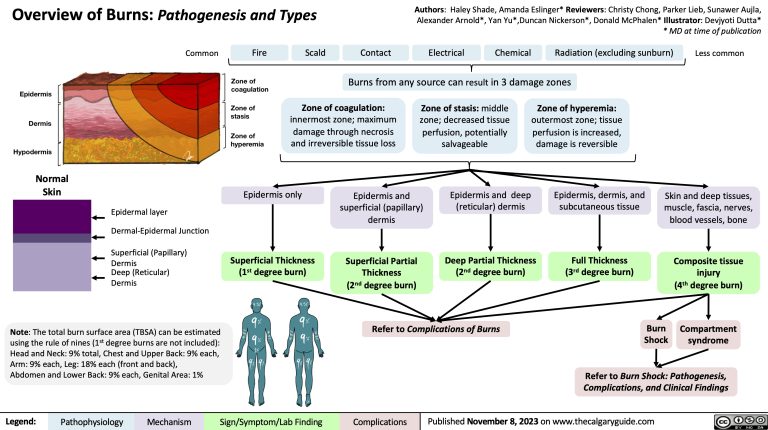 Overview of Burns: Pathogenesis and Types | Calgary GuideCalgary Guide