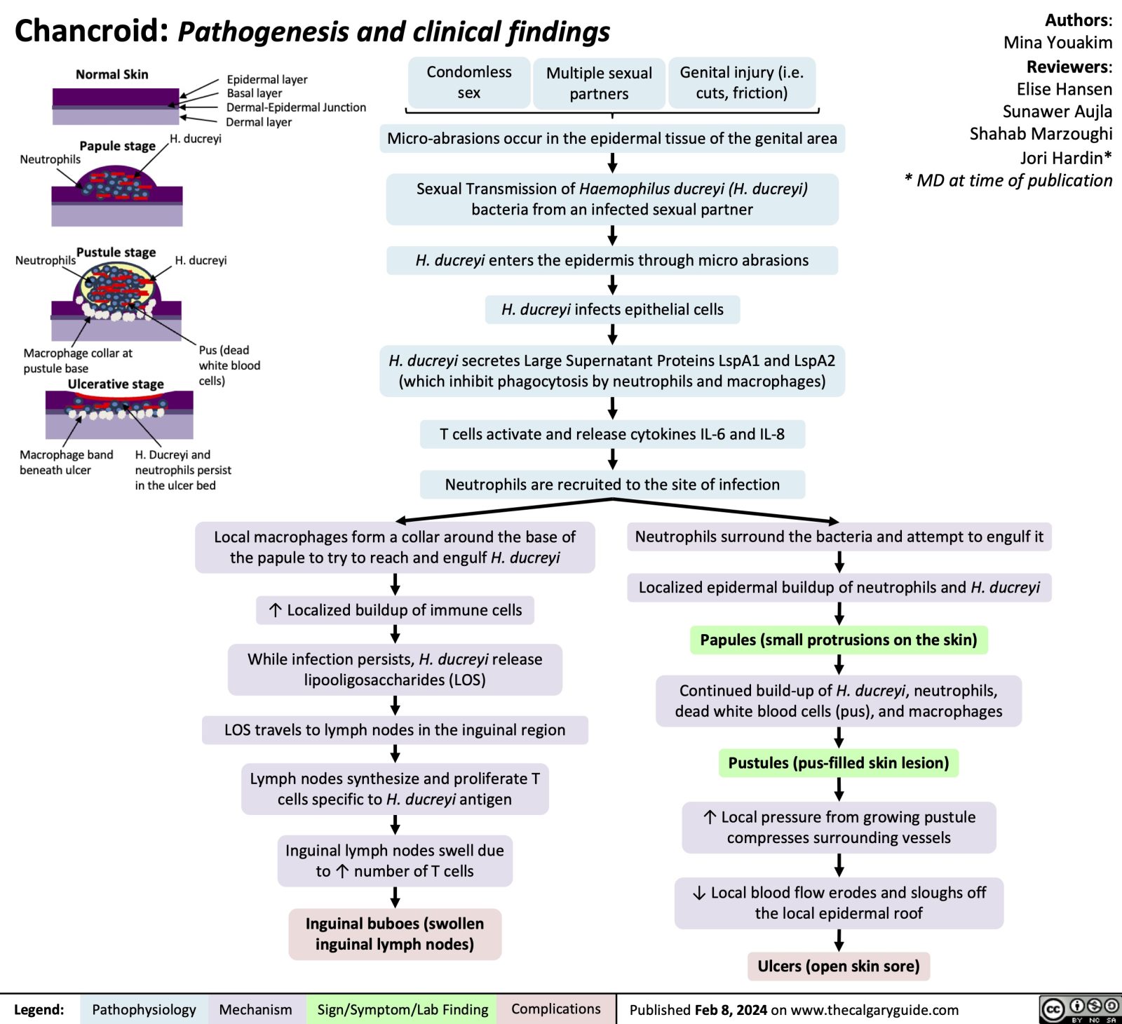 Chancroid | Calgary GuideCalgary Guide