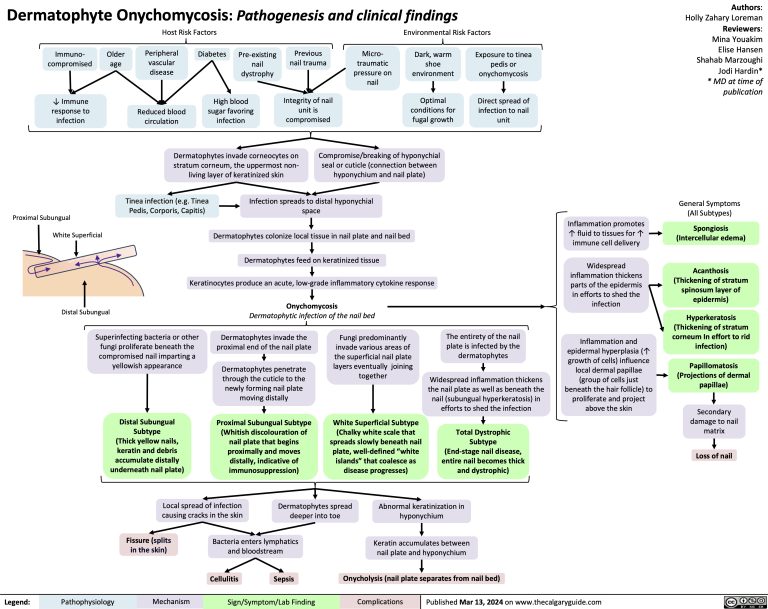 Onychomycosis | Calgary GuideCalgary Guide
